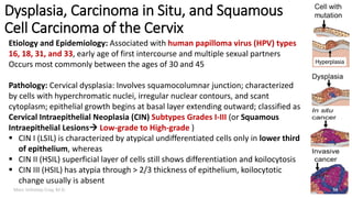 Basal Cell Carcinoma Vs Squamous Cell Carcinoma Usmle