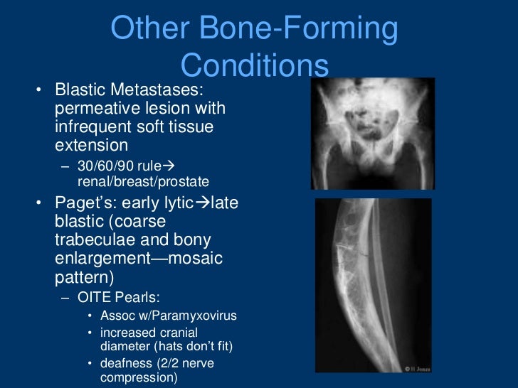 Oncology oite-review-2012
