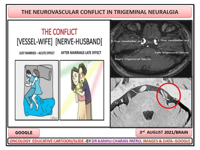 Oncology cartoons 65th volume | PPTX