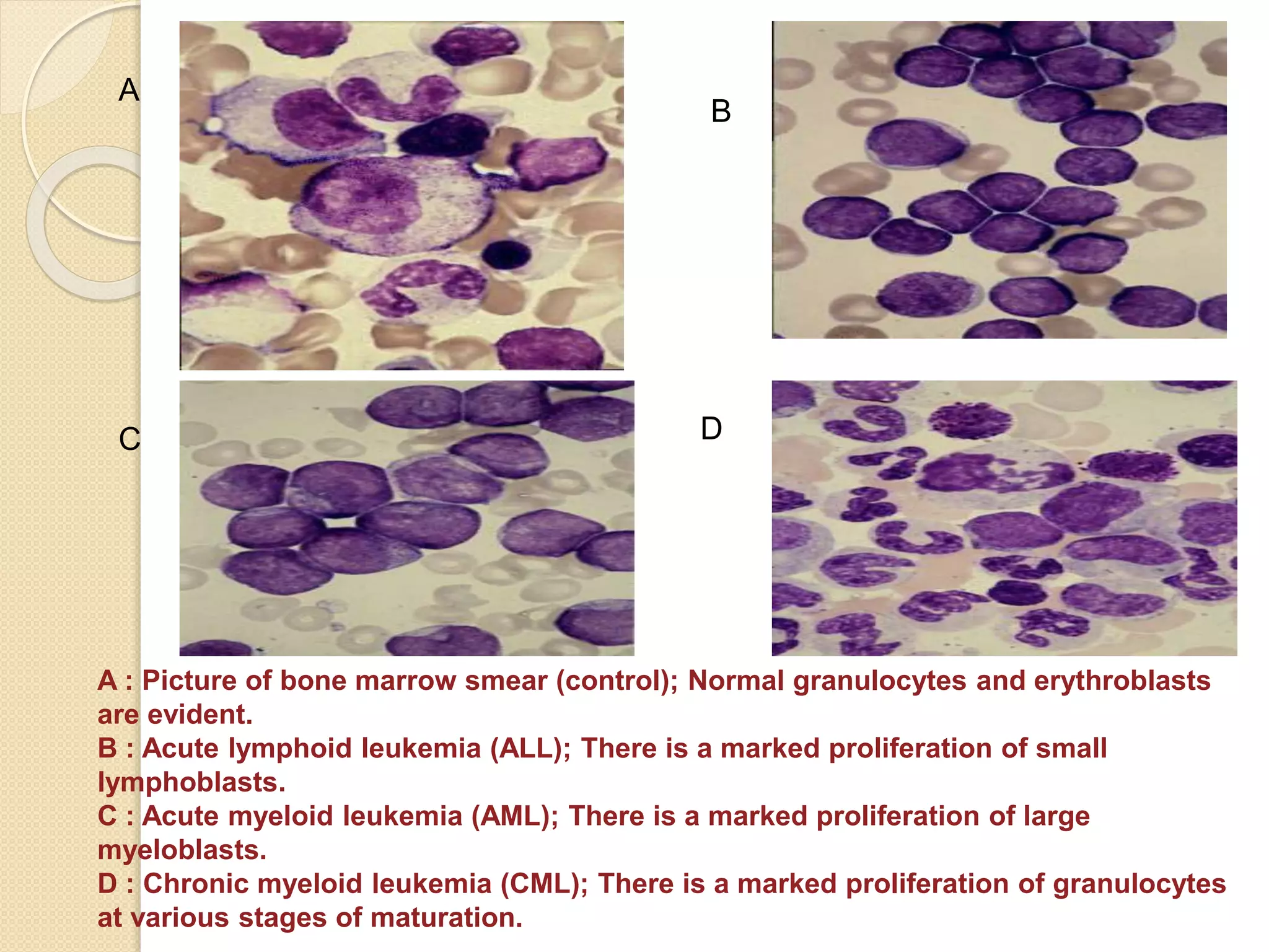 Oncology disorder | PPTX