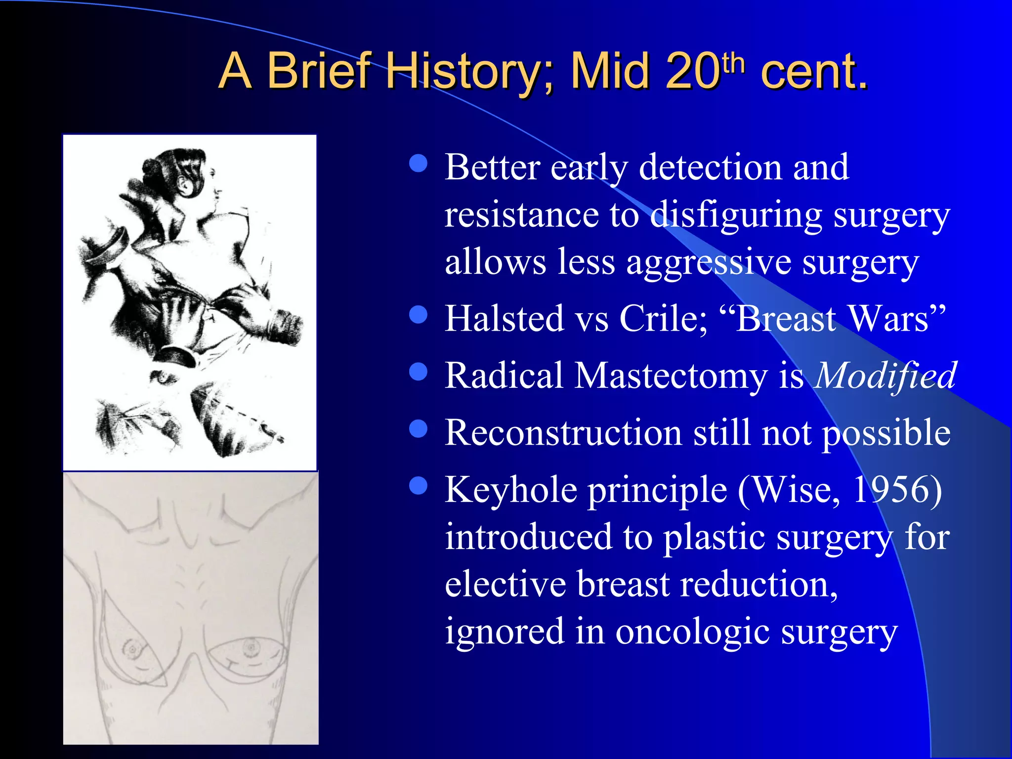 Breast Preservation Foundation: Oncoplastic Talk, Dallas, 12/5/09 | PPT