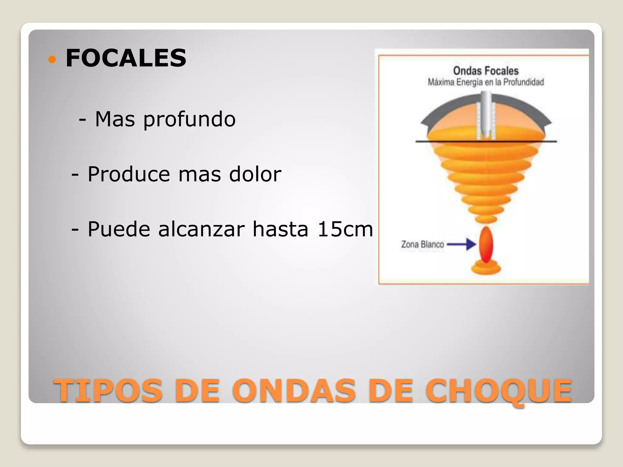 ONDAS DE CHOQUE (1) (1).pptx