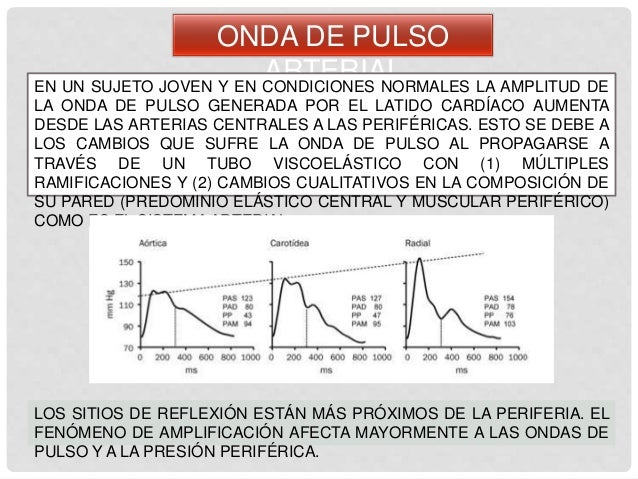 ONDAS DE PULSO