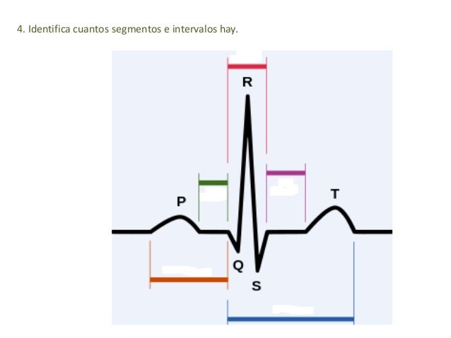 Electrocardiograma Ondas