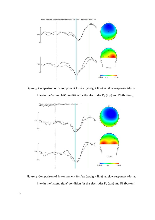 Posner task results | PDF