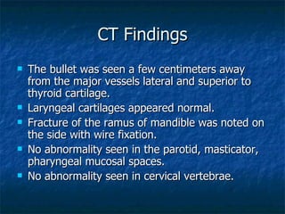 One Bullet Story: Nepal | PPT