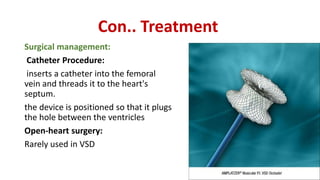 ventricular septal defect | PPTX