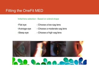 ONE FIT SCLERAL LENS.ppt