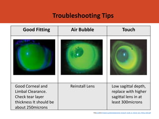 ONE FIT SCLERAL LENS.ppt