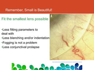 ONE FIT SCLERAL LENS.ppt