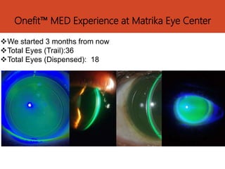 ONE FIT SCLERAL LENS.ppt