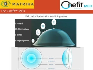 ONE FIT SCLERAL LENS.ppt
