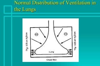 One Lung Ventilation | PPT