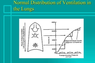 One Lung Ventilation | PPT