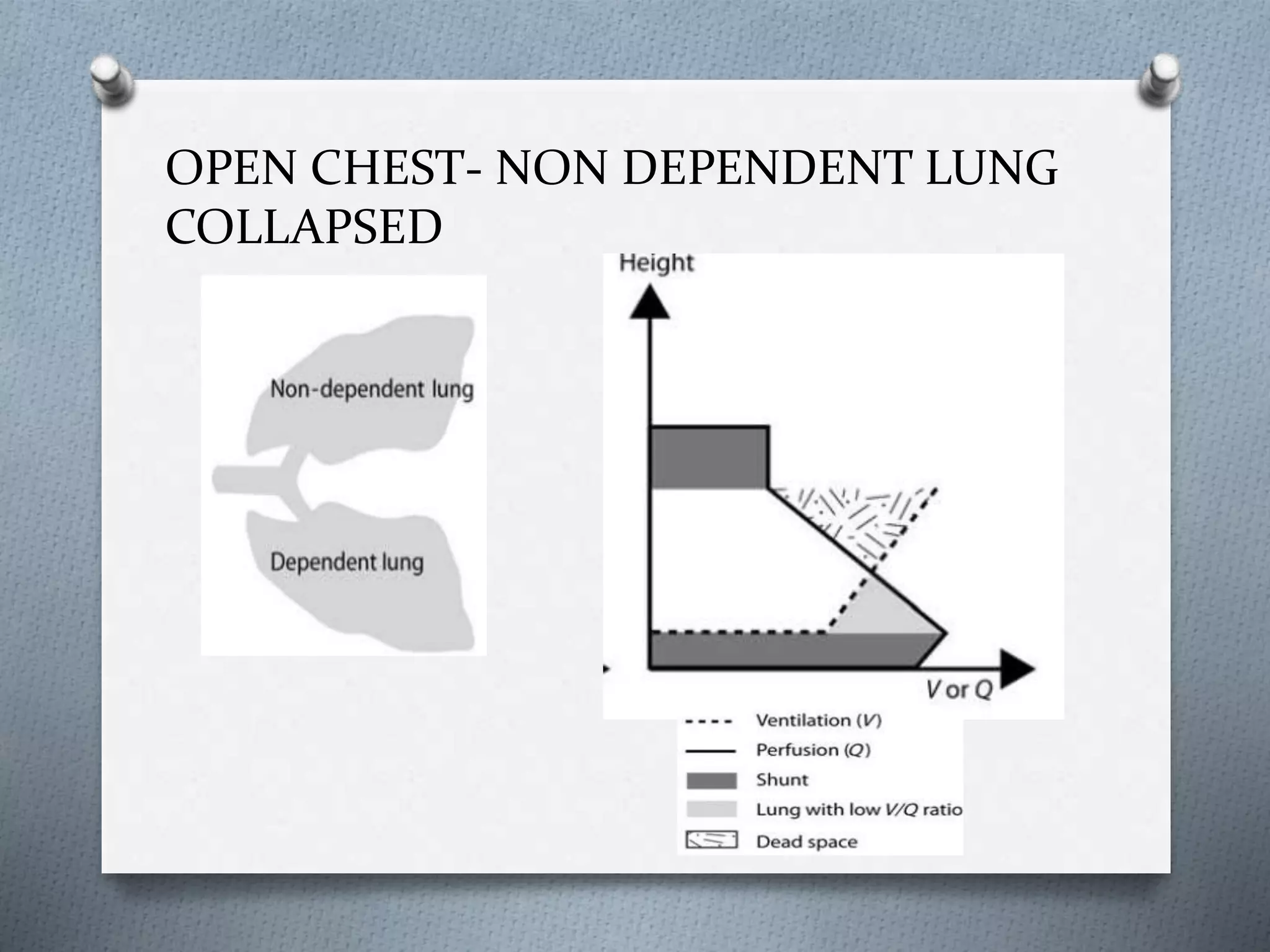 One lung ventilation | PPTX
