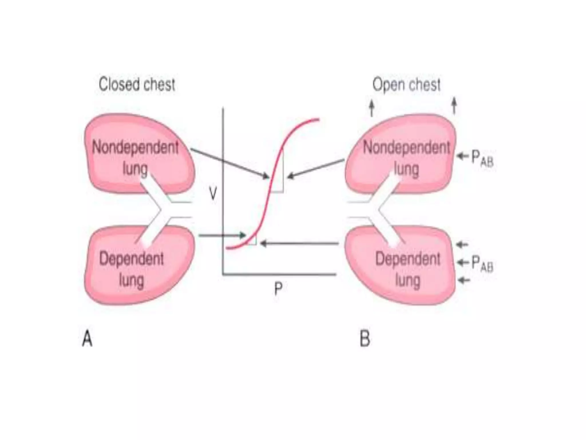 One lung ventilation | PPT