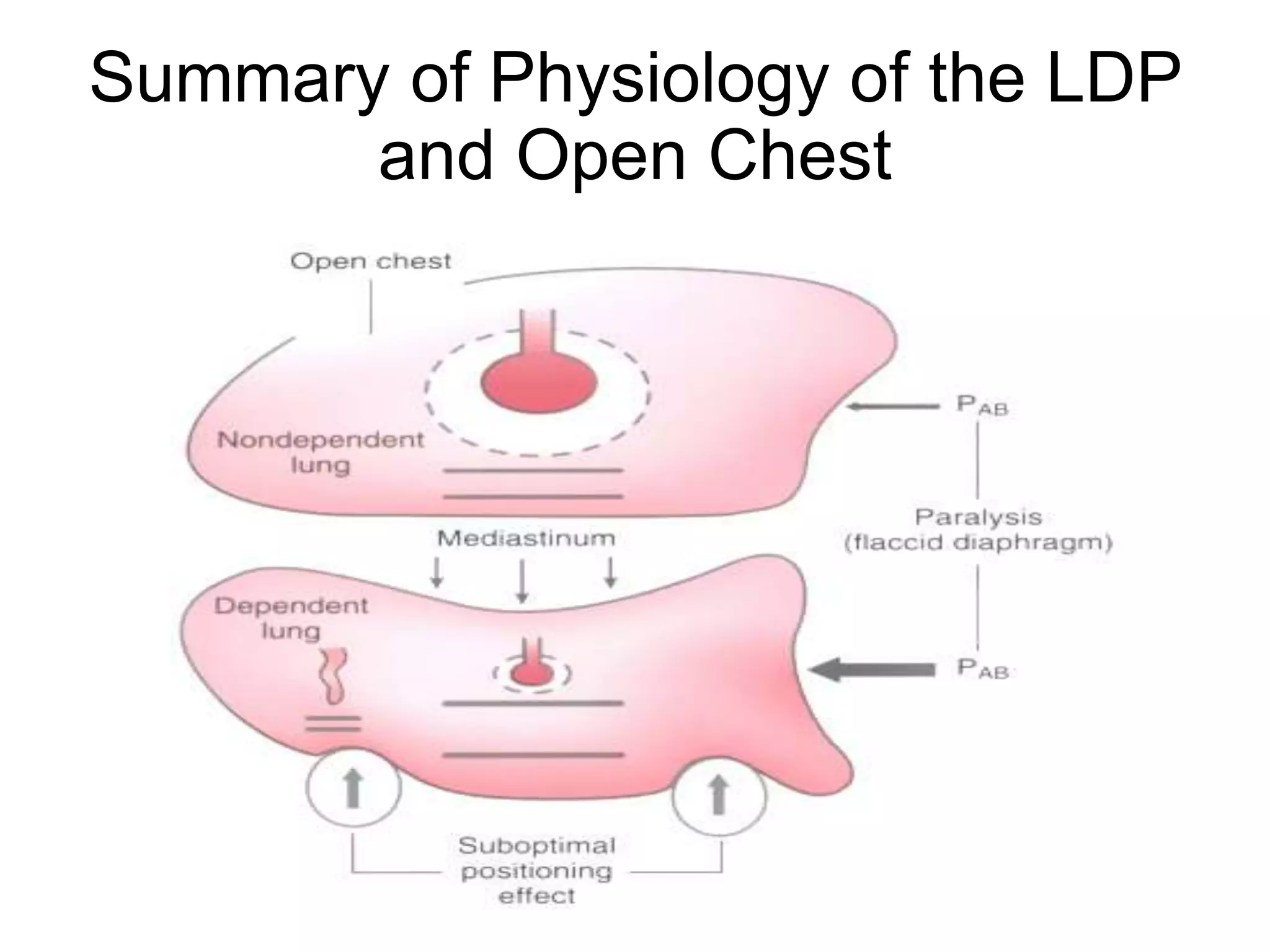 One lung ventilation | PPT