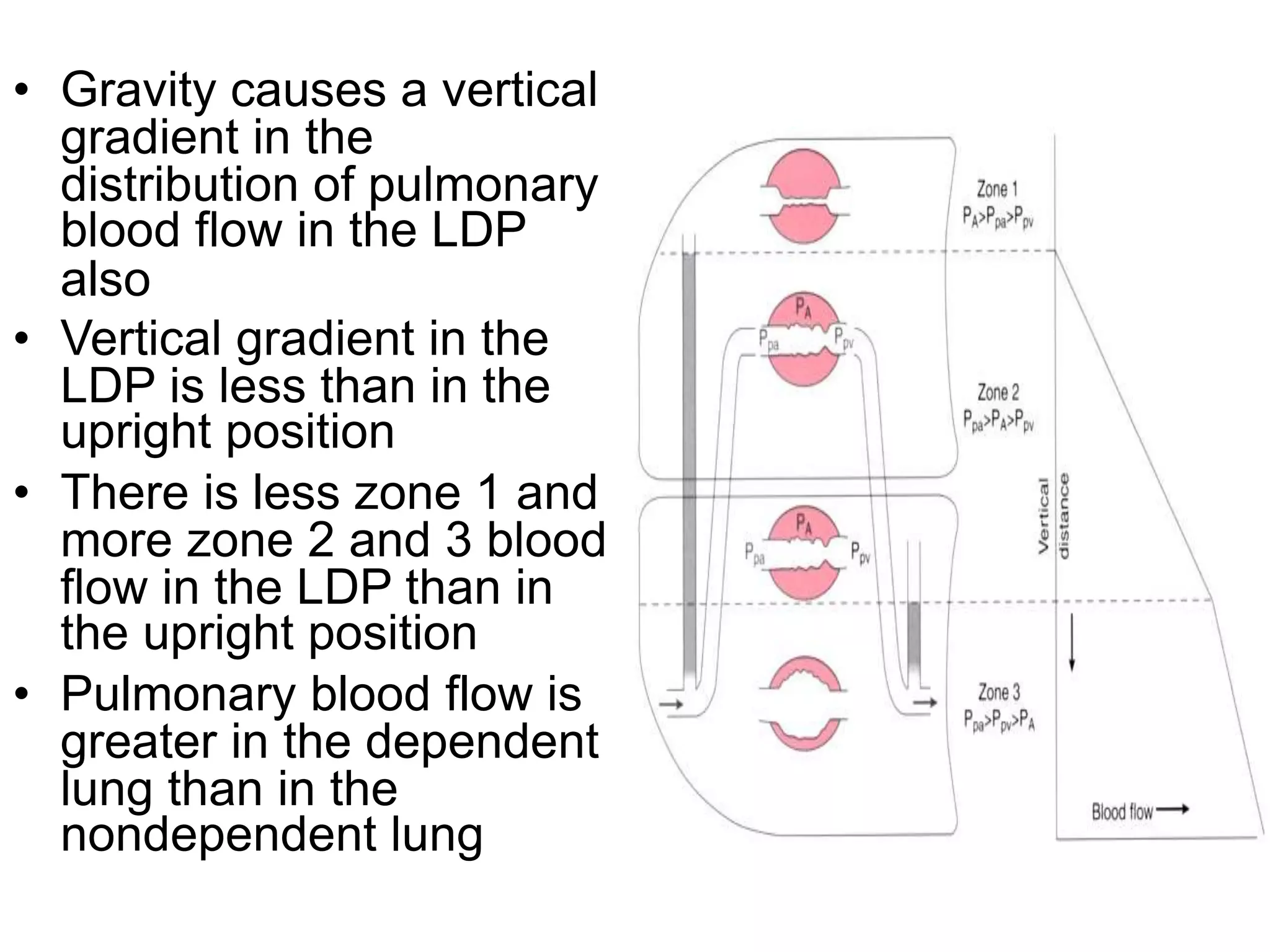 One lung ventilation | PPT