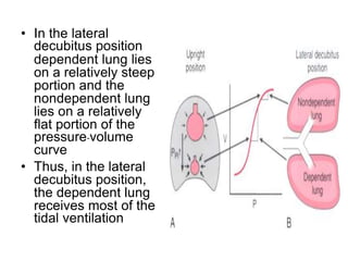 One lung ventilation | PPT