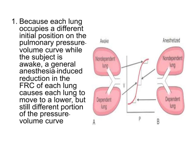 One lung ventilation | PPT