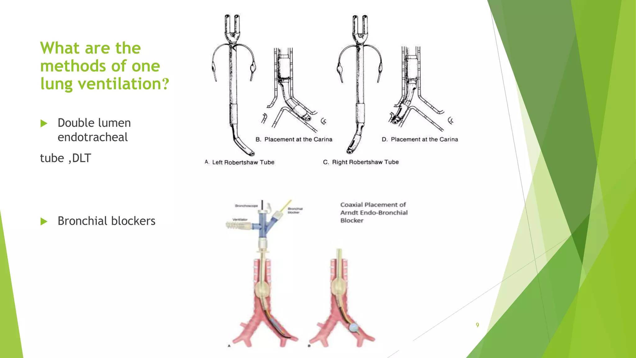 One lung ventilation | PPTX