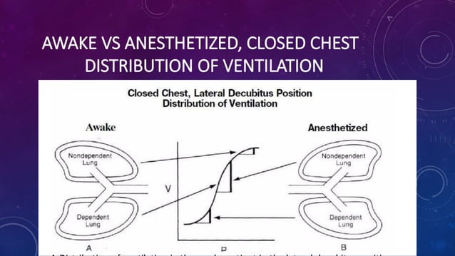 ONE LUNG VENTILATION PHYSIOLOGY AND TECHNIQUES | PPT