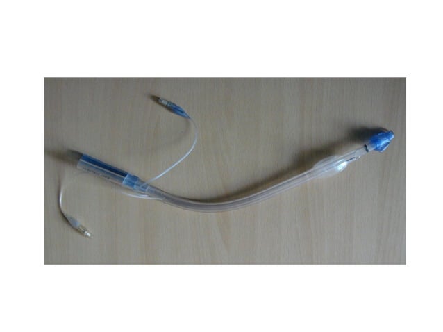 One lung ventilation | PPT | Lung and Respiratory Health | Diseases and ...