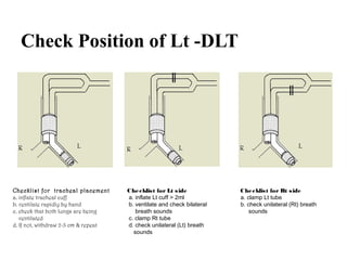 One lung ventilation | PPT