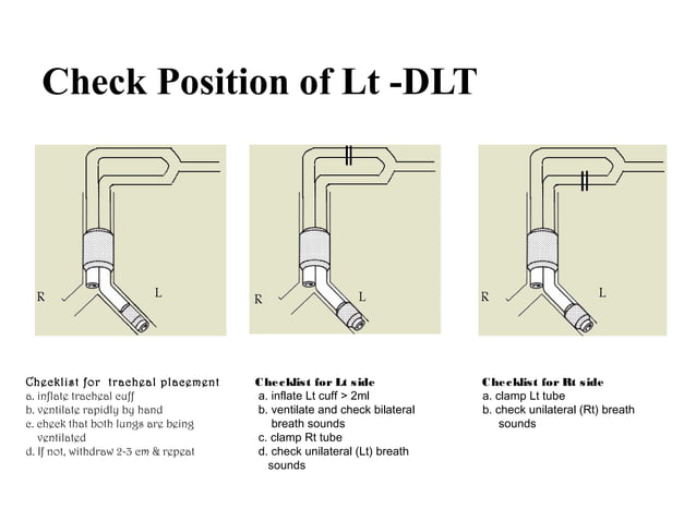 One lung ventilation | PPT | Lung and Respiratory Health | Diseases and ...
