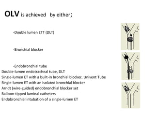 One lung ventilation | PPT