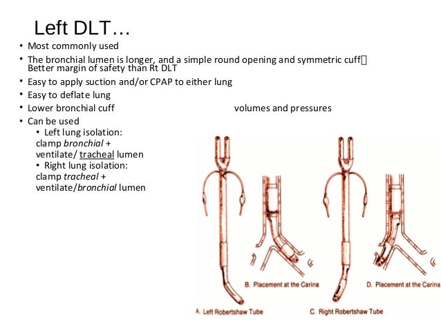One lung ventilation