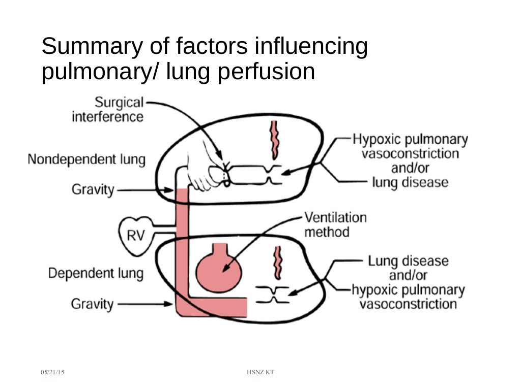 One lung ventilation