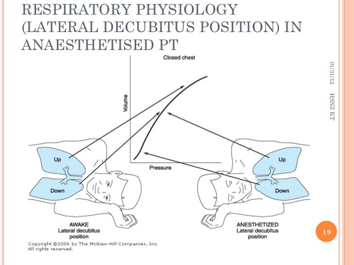 One lung ventilation kweq part 1