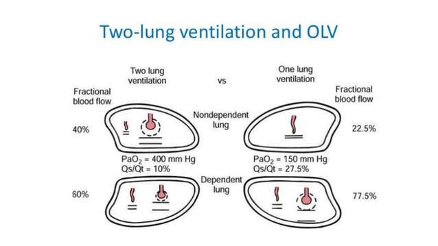 one lung ventilation and anaesthetic management and considerations | PPT