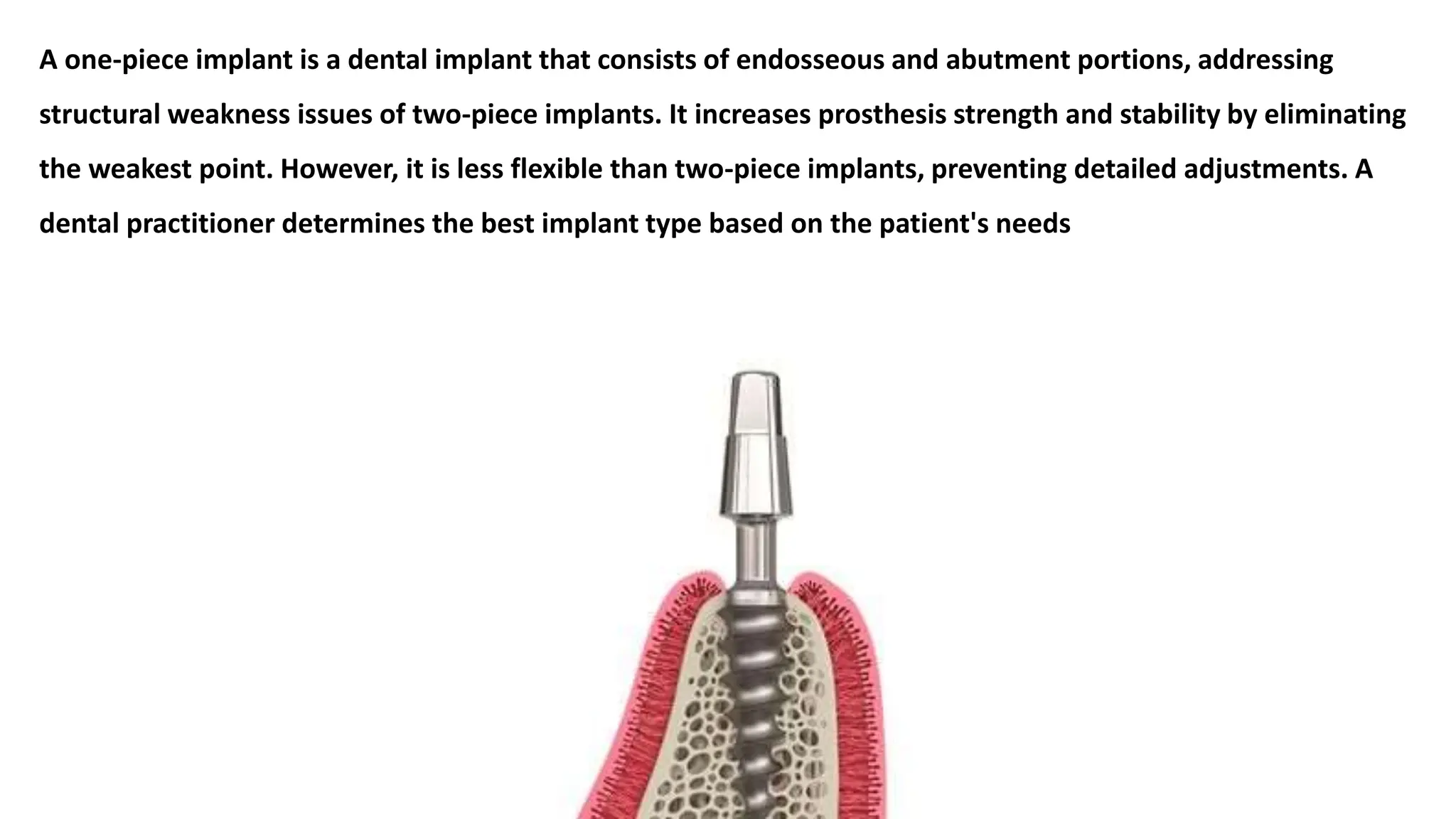 One piece compressive Dental implant : data from Google Scholar | PPTX