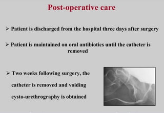 One stage urethroplasty using skin flap | PPT