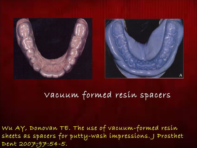 Modified One Step Putty Wash Technique | PPT | Oral care | Personal Care