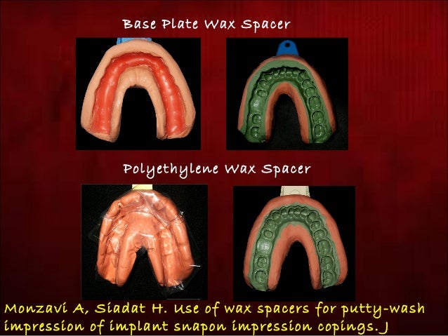Modified One Step Putty Wash Technique