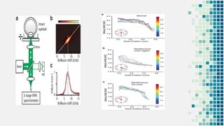 One way to optimize Corneal Cross linking (CXL) !! | PDF