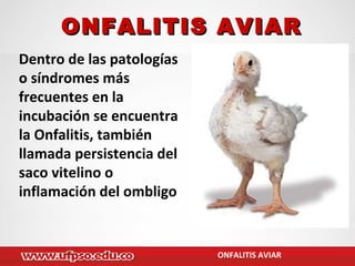 Onfalitis | PPT