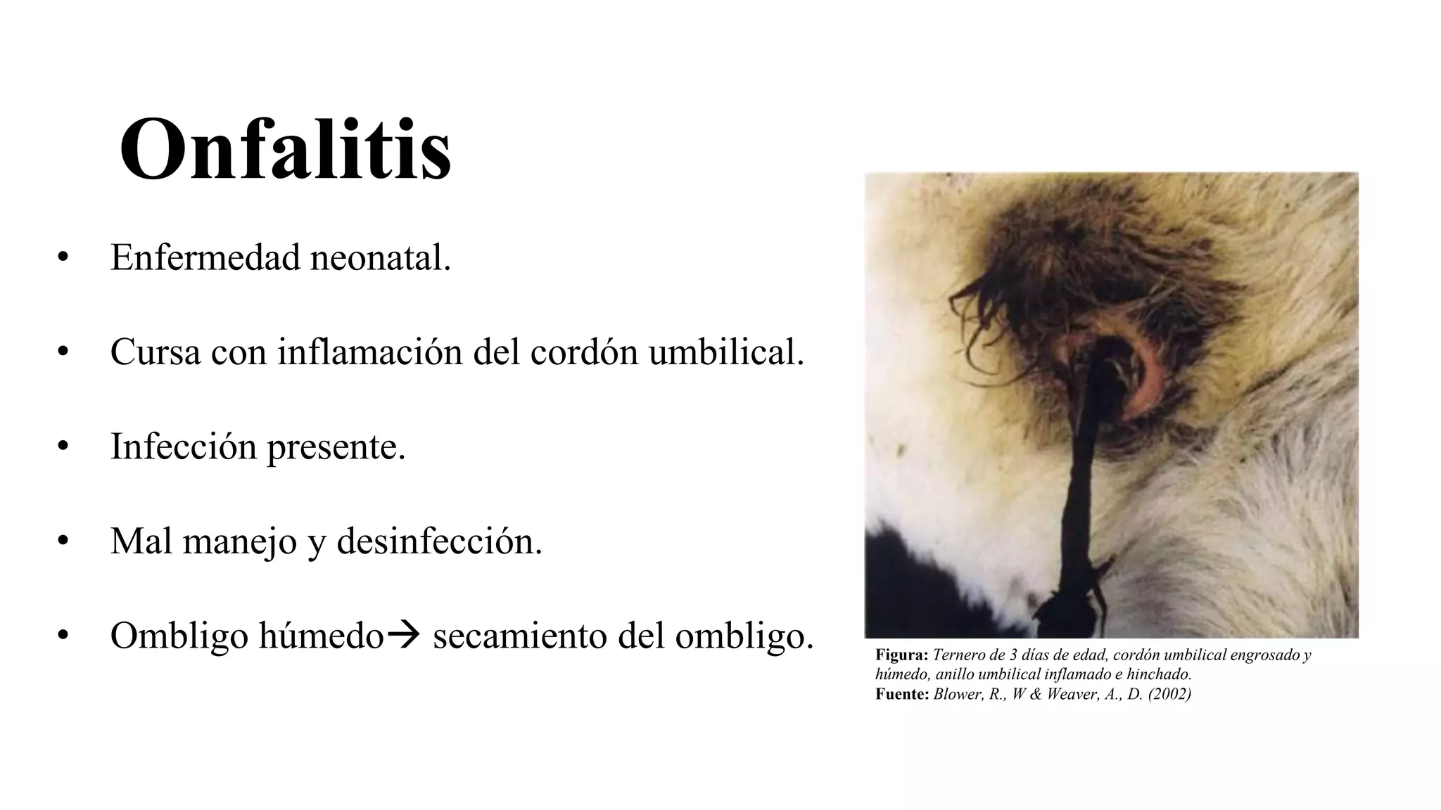 Onfalitis | PPTX