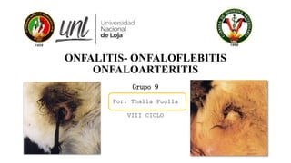 Onfalitis | PPTX