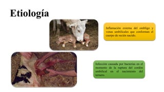 Onfalitis | PPTX