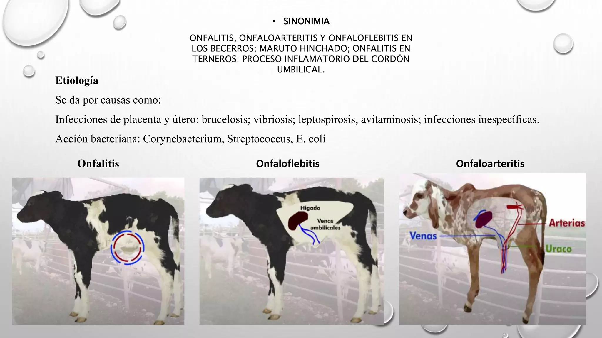 Onfalitis | PPTX | Medical Health