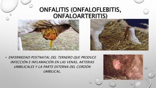 Onfalitis | PPTX
