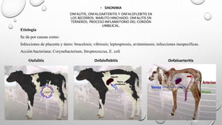 Onfalitis | PPTX