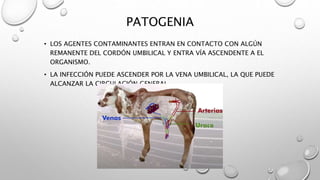 Onfalitis | PPTX