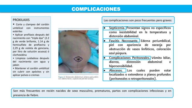 ONFALITIS - CMCM.pptx