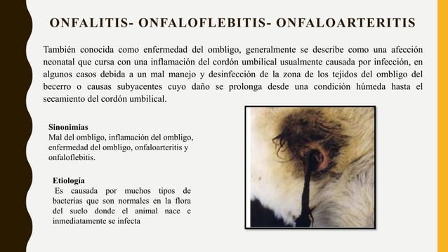 Onfalitis onfaloflebitis- onfaloarteritis | PPT