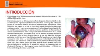 ONFALOCELE PRÁCTICA.pptx